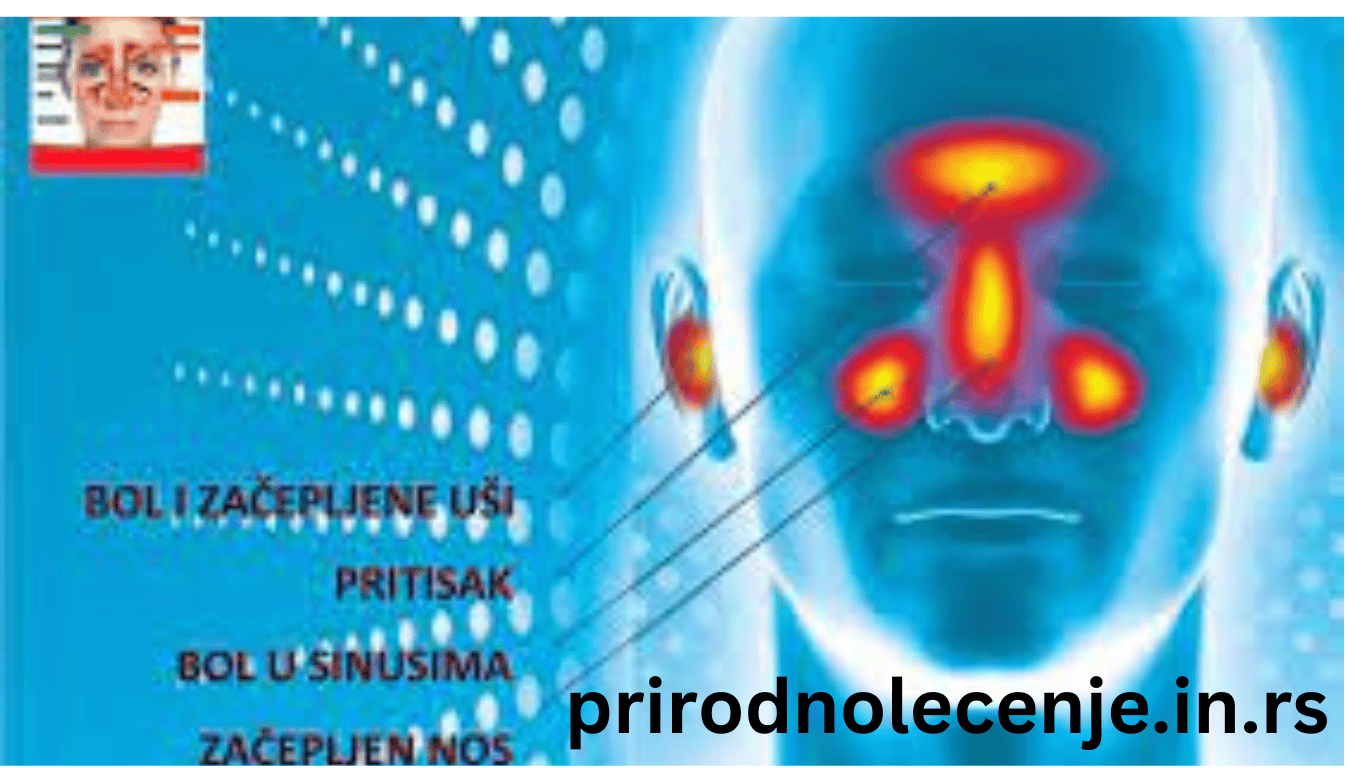 Sinusi, Upala (sinuzitis) 2023